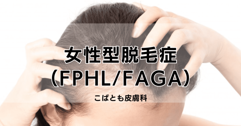 女性型脱毛症（FPHL/FAGA）｜こばとも皮膚科｜栄駅（名古屋市栄区）徒歩2分