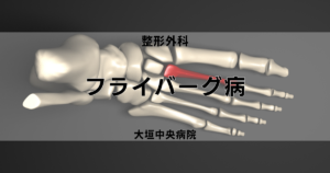 フライバーグ病（第2ケーラー病） | 医療法人社団豊正会 大垣中央病院