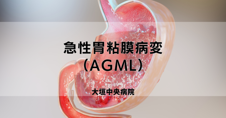 急性胃粘膜病変（AGML） | 医療法人社団豊正会 大垣中央病院