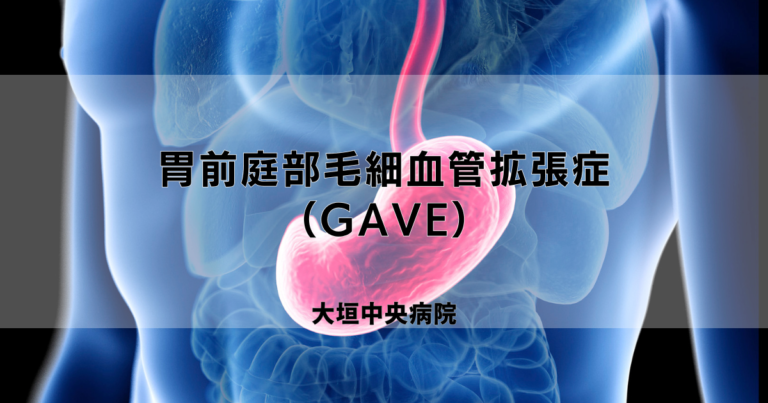 胃前庭部毛細血管拡張症（GAVE） | 医療法人社団豊正会 大垣中央病院