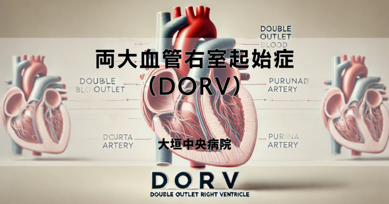 両大血管右室起始症（DORV） | 医療法人社団豊正会 大垣中央病院