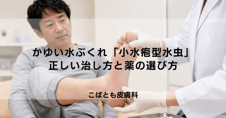 かゆい水ぶくれができる「小水疱型水虫」の正しい治し方と薬の選び方｜こばとも皮膚科｜栄駅（名古屋市栄区）徒歩2分